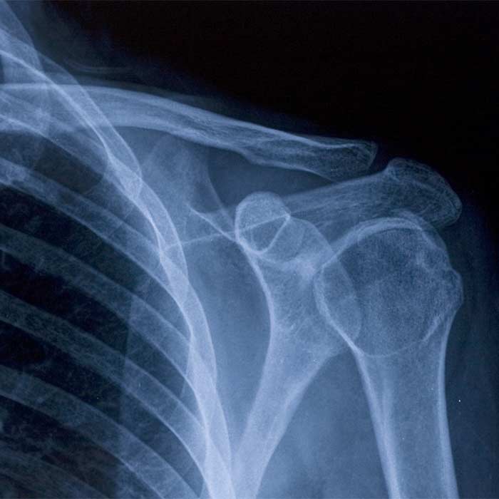 Press releases and enquires | The Royal Mint